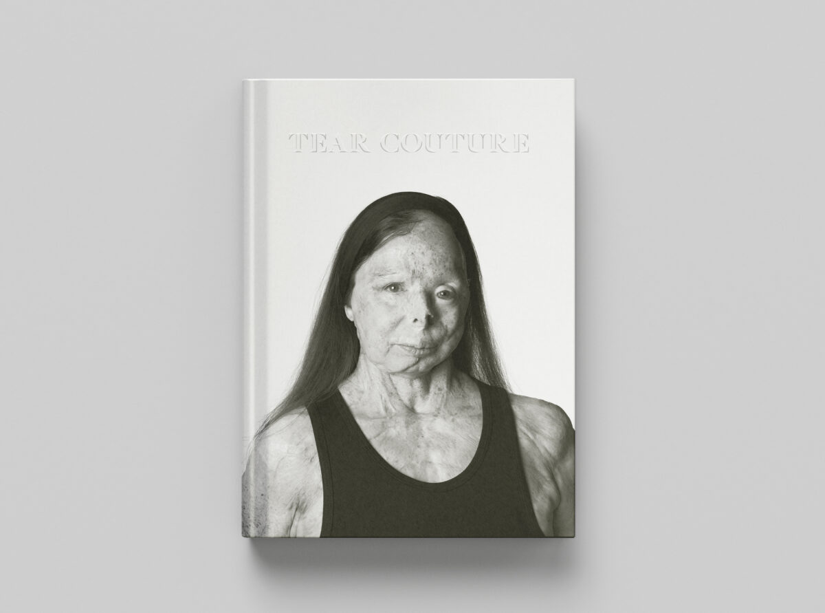 Rankin enlisted for powerful acid attack awareness campaign